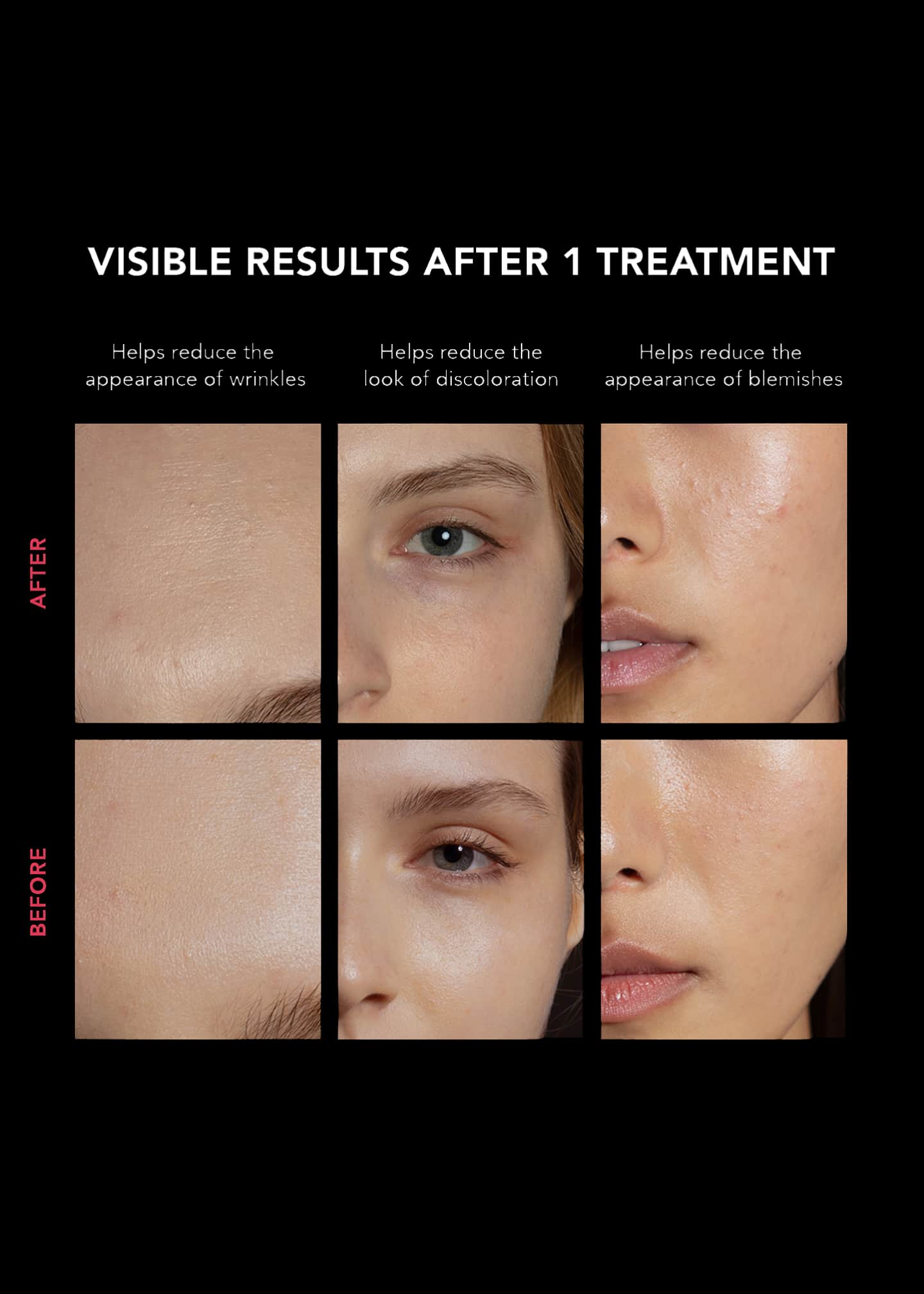 Foreo FAQ 202 Wireless Silicone LED Face Mask - Bergdorf Goodman