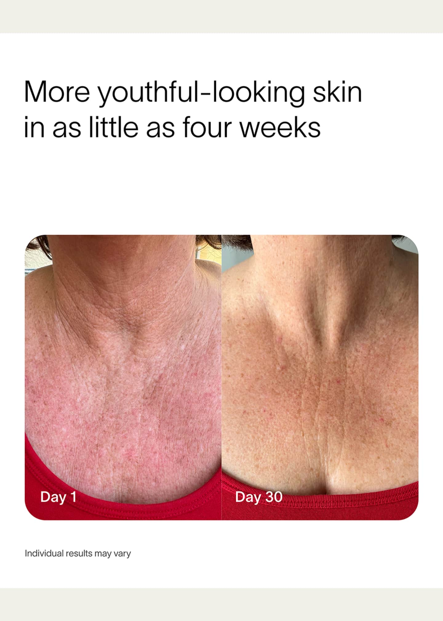 SolaWave Radiant Renewal Neck & Chest Mask - Bergdorf Goodman