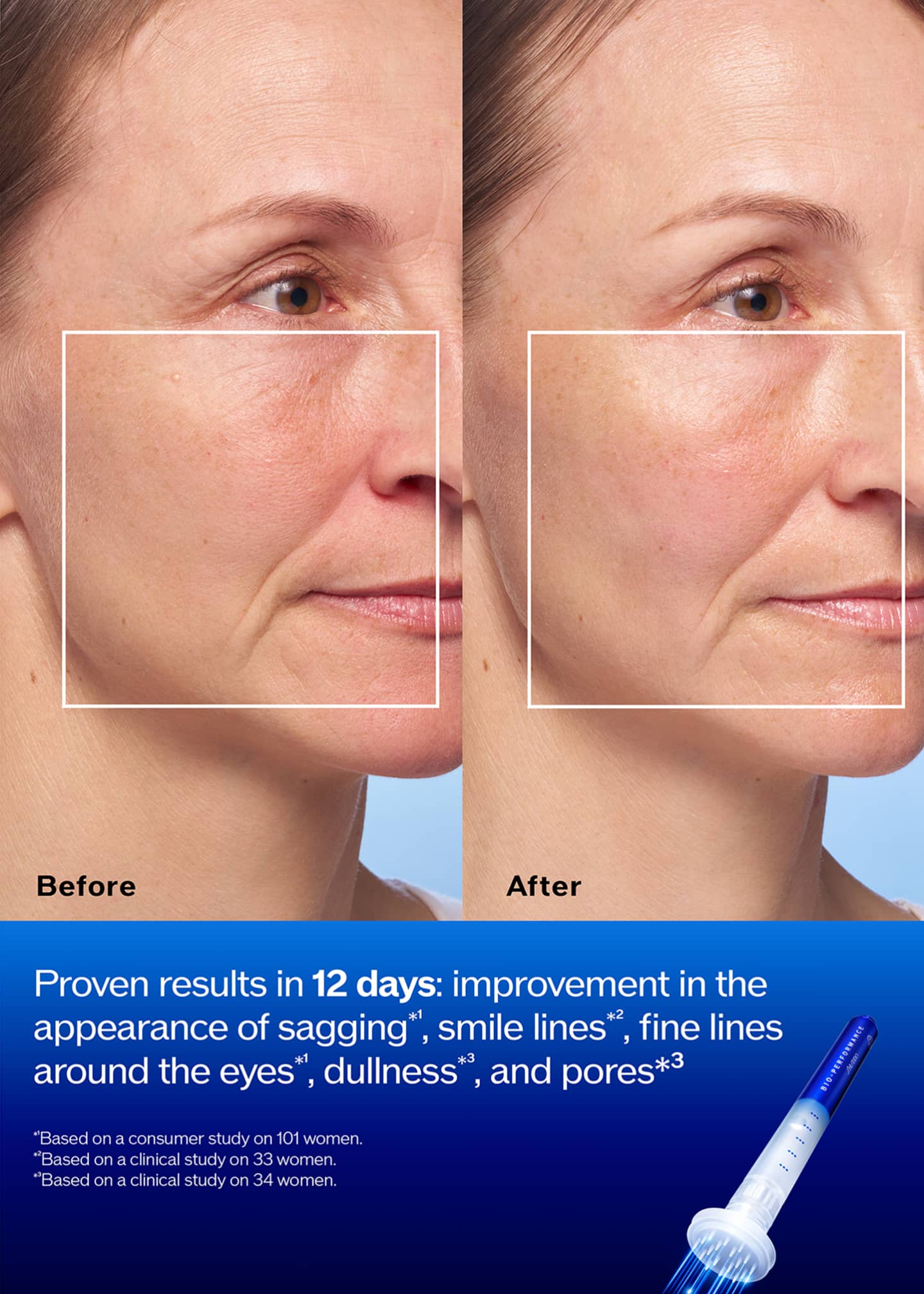 Shiseido Bio-Performance Skin Micro Click Concentrate, 1.4mL - Bergdorf ...