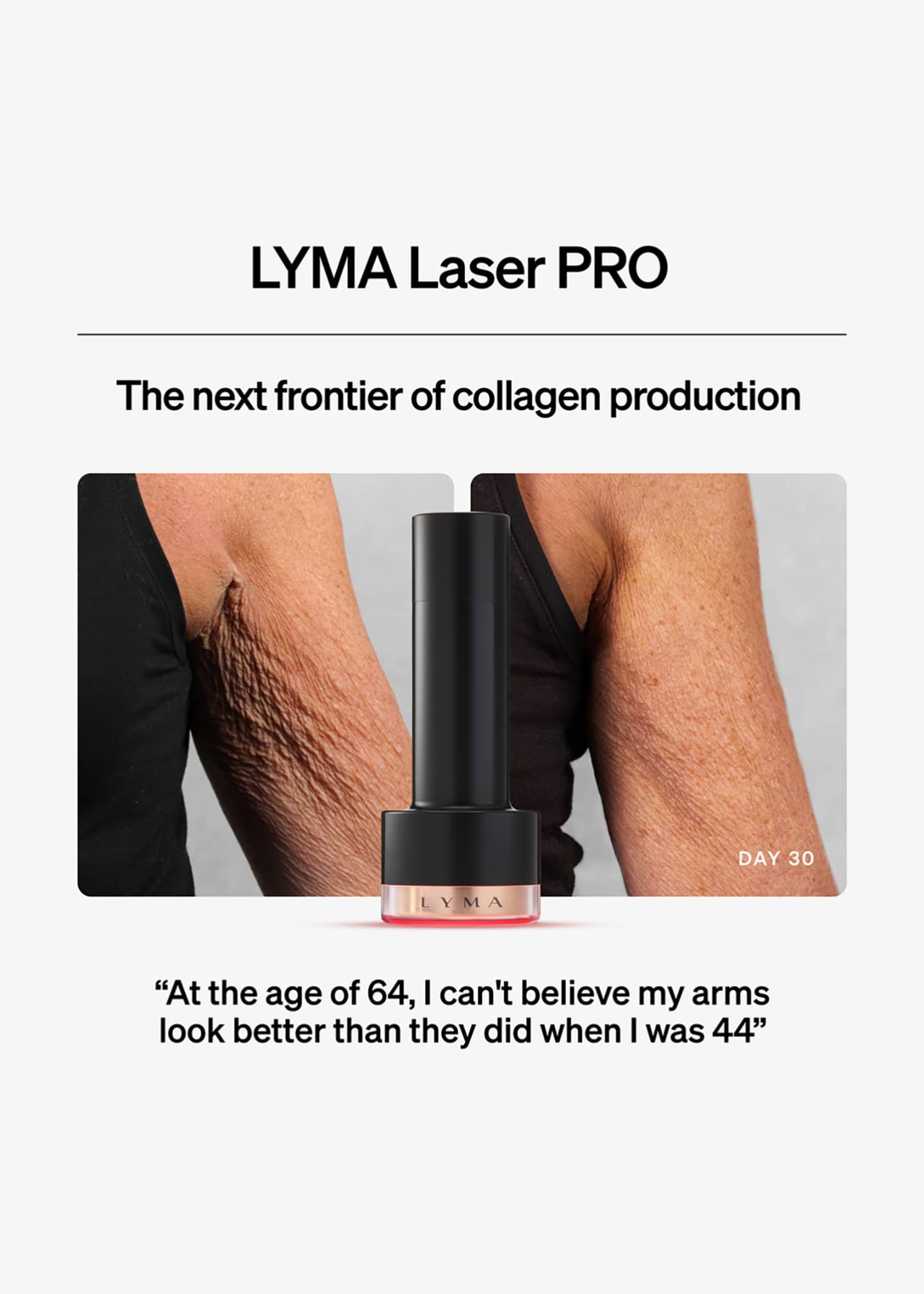 LYMA Lyma Laser PRO Starter Kit - Bergdorf Goodman