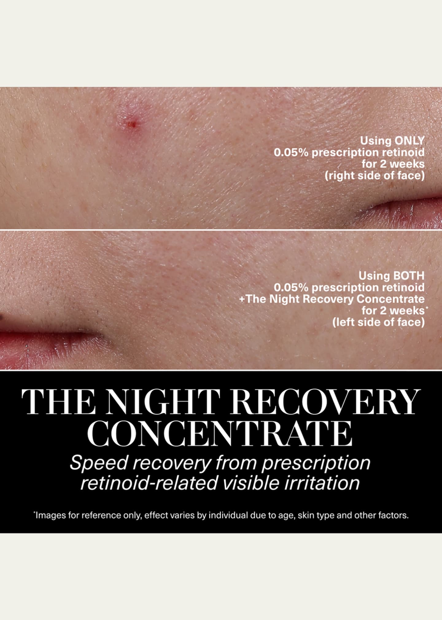 La Mer The Night Recovery Concentrate, 0.5 oz. - Bergdorf Goodman